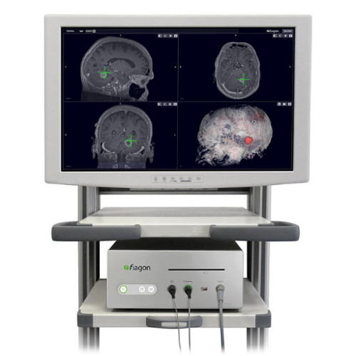 Neuronavegador Electromagnetico Fiagon - Varlix