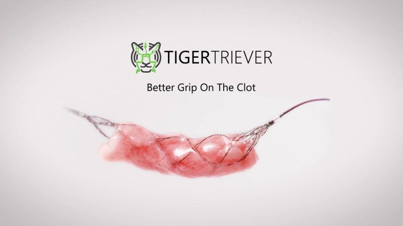 Stent Retriever Tigertriever - Rapid Medical - Varlix