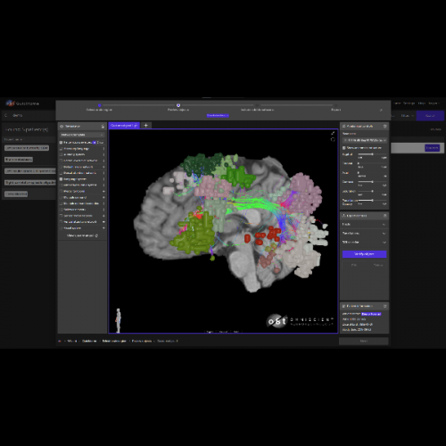 Mapeo Cerebral Quicktome® Omniscient Neurotechnology - Varlix